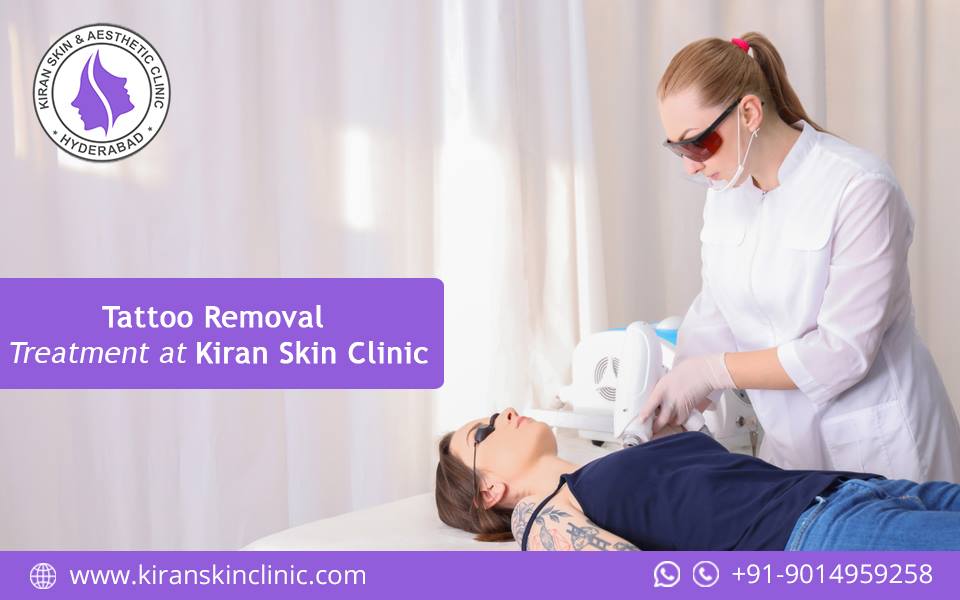 Tattoo Removal In Hyderabad Permanent Tattoo Removal In Hyderabad