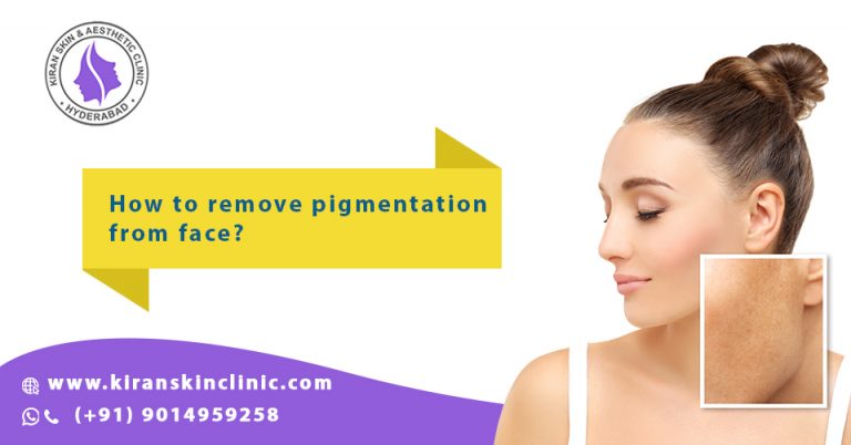 How to Remove Pigmentation from face - kiranskinclinic